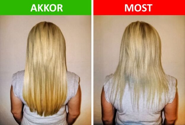 8 dolog, amit a hajad elárulhat az egészségedről | Kuffer 8 dolog, amit a hajad elárulhat az egészségedről | Kuffer