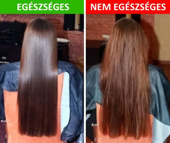 8 dolog, amit a hajad elárulhat az egészségedről | Kuffer 8 dolog, amit a hajad elárulhat az egészségedről | Kuffer